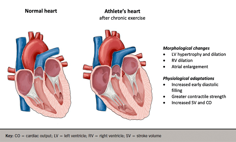 Athlete’s Heart and Sudden Cardiac Death – SCIFAA